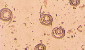 Discover The 3 Most Prevalent Pork Parasites And Their Harmful Effects ...